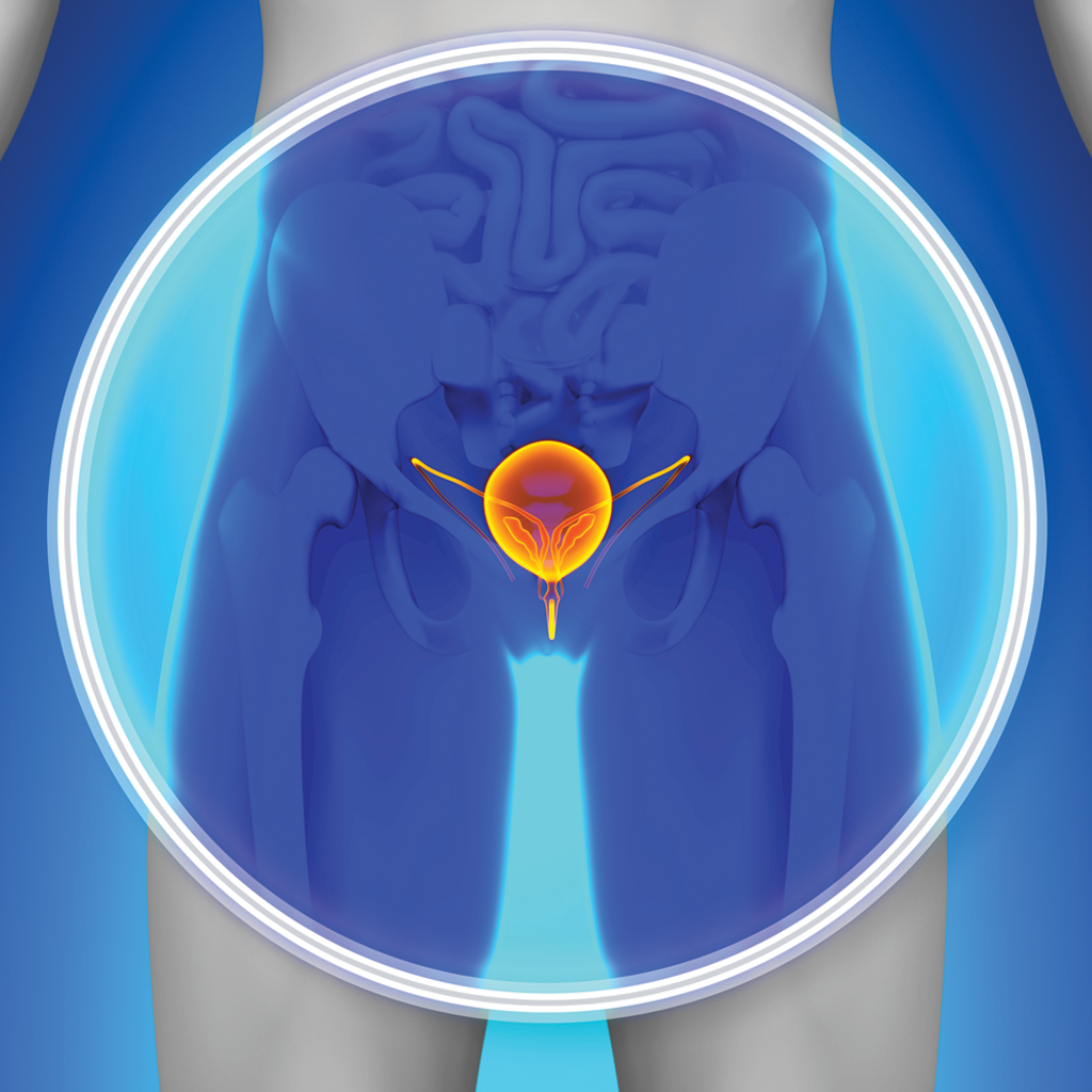 Effective Enlarged Prostate Treatment at PrecisionIR, MI